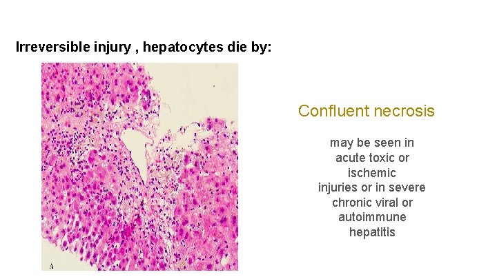 Liver Gallbladder Pathology Ghadeer Hayel M D Histopathologist