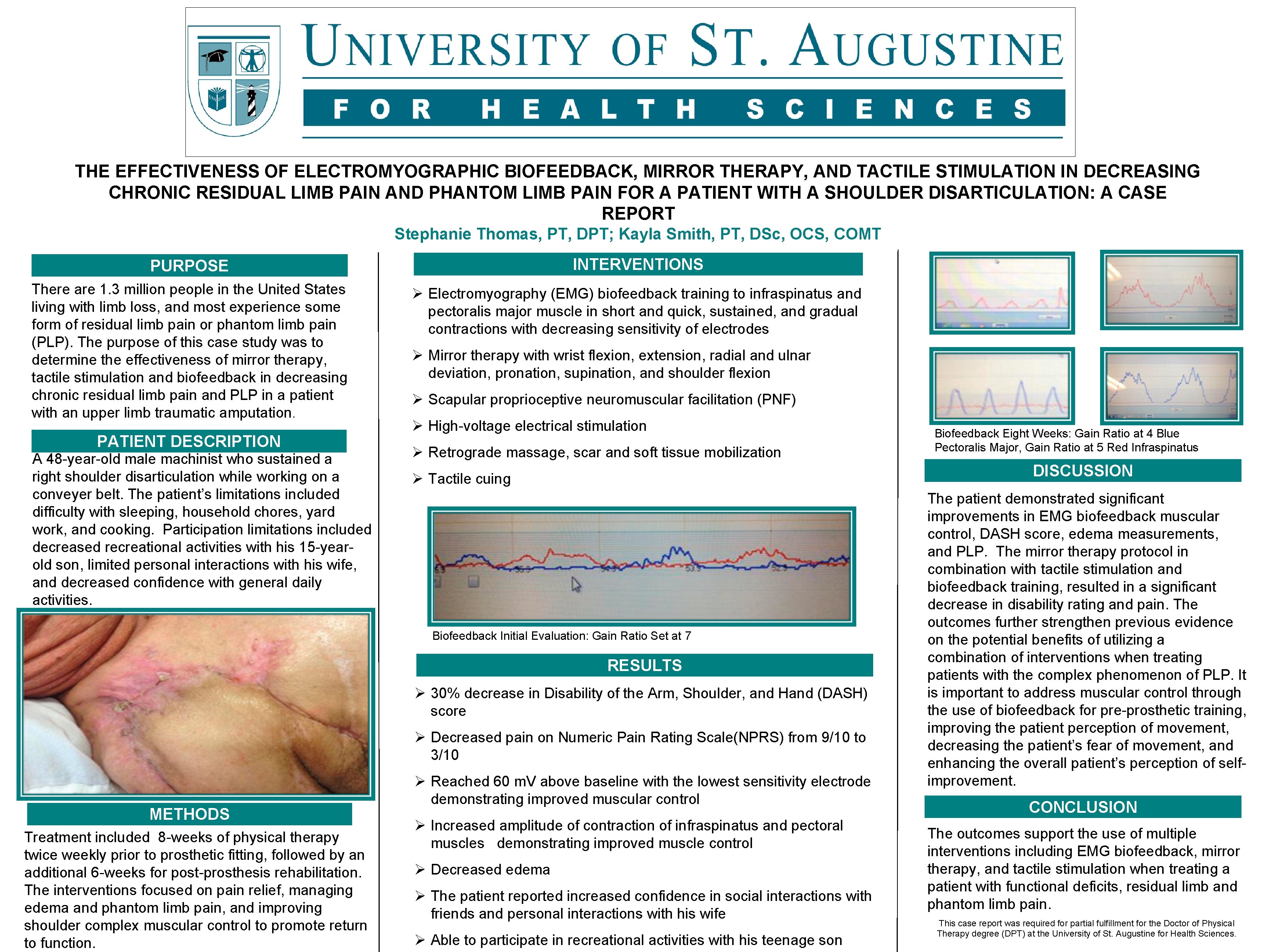 THE EFFECTIVENESS OF ELECTROMYOGRAPHIC BIOFEEDBACK MIRROR THERAPY AND