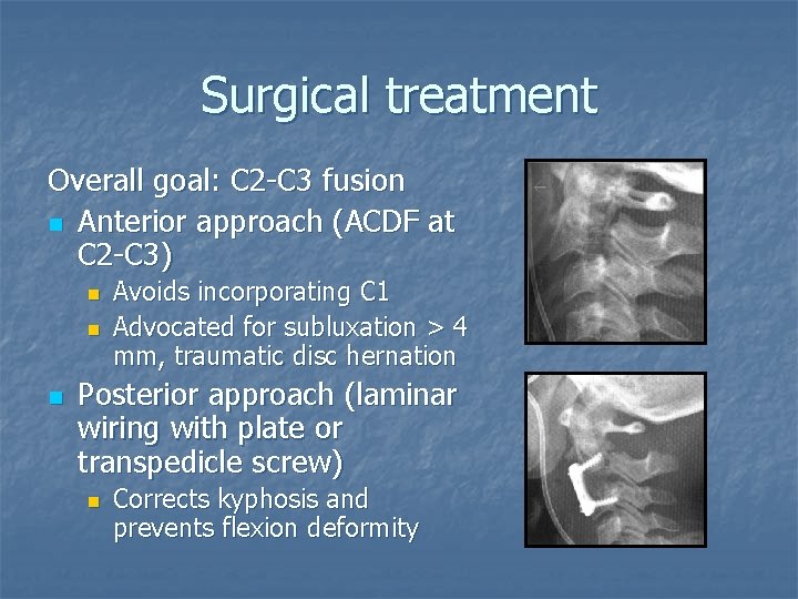 Hangmans Fractures Hangmans Fracture n n n Definition