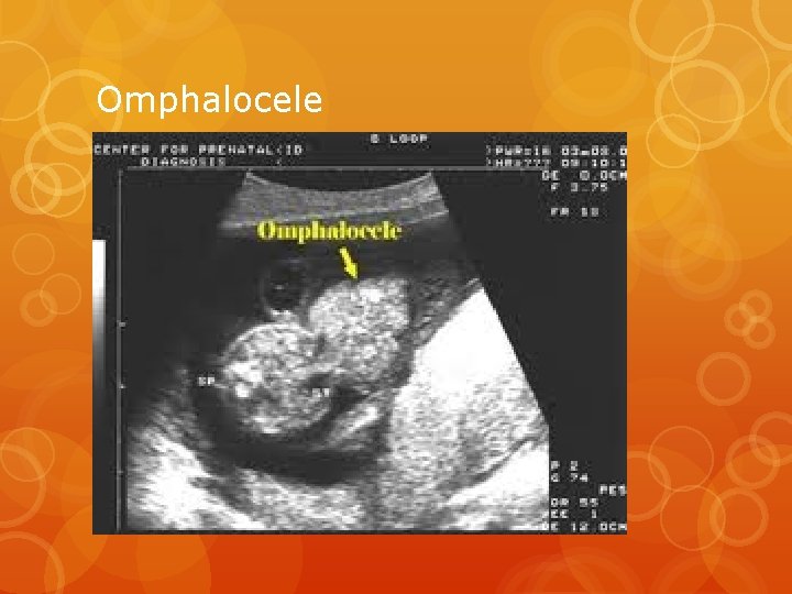 Obstetrical Sonography II Lecture 15 The Fetal Abdominal
