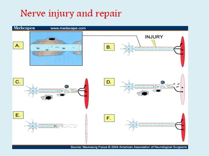 Peripheral Nervous System Pathologies Dr S Nishan Silva