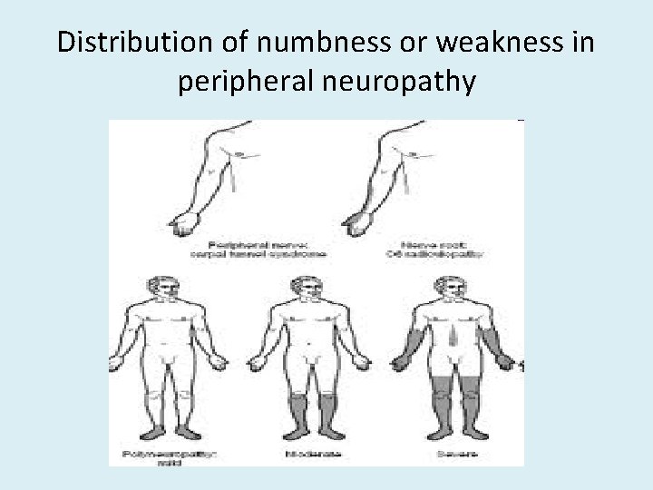 Peripheral Nervous System Pathologies Dr S Nishan Silva