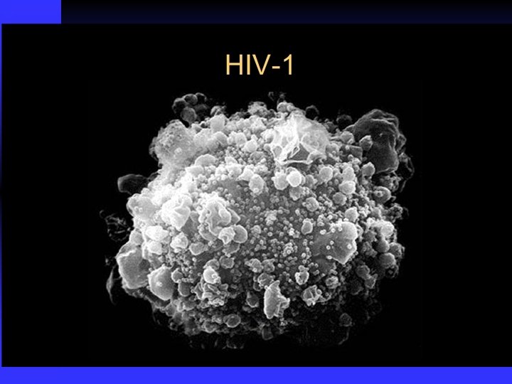 INFEZIONE DA HIV Epidemiologia AIDS cronologia HIV1 i