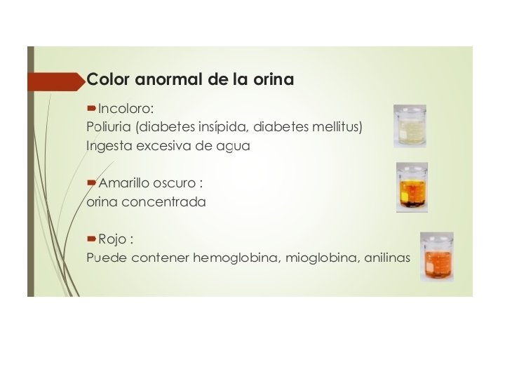 Tema 10 b BIOQUIMICA DE LA ORINA PARTE