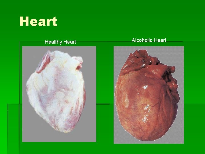 Alcohol Addiction Entry Task How does the body