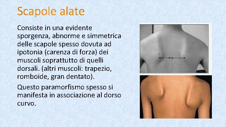 La colonna vertebrale risponde di tutto il funzionamento