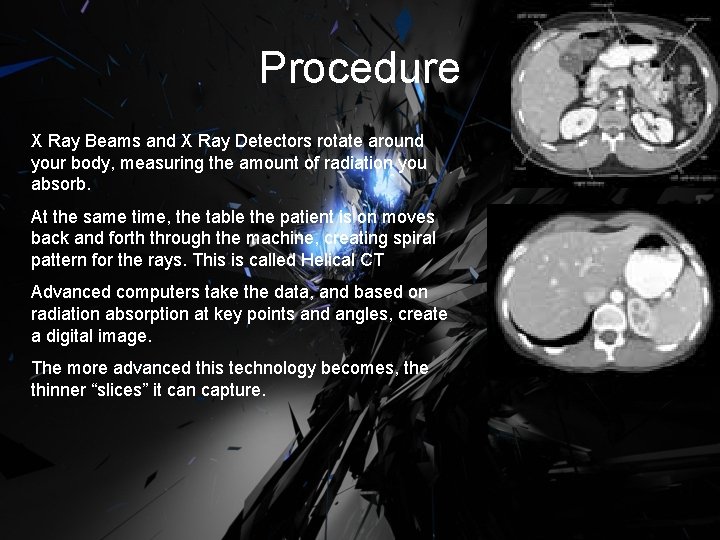 Dr Alessandro Vallebona proposed a method to represent