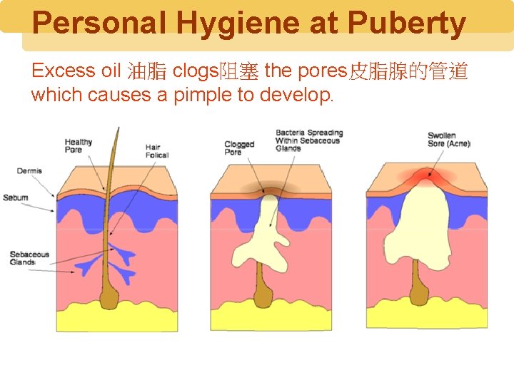 Personal Hygiene at Puberty What should we do