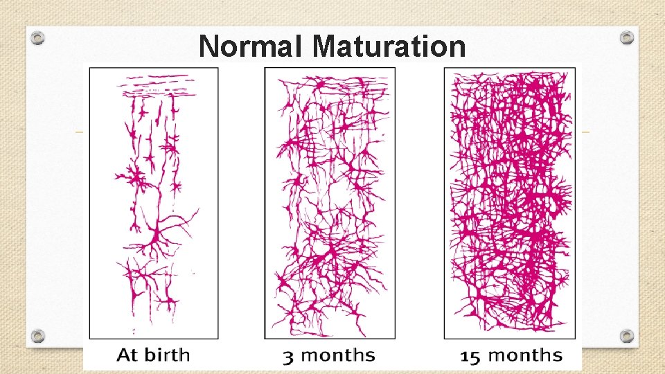 Developmental Unit 9 Neonate newborn REFLEXES Rooting Graspin