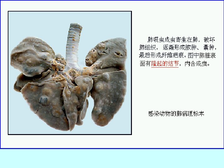 PARAGONIMIASIS Paragonimus westermani lung fluke A miracidium hatching