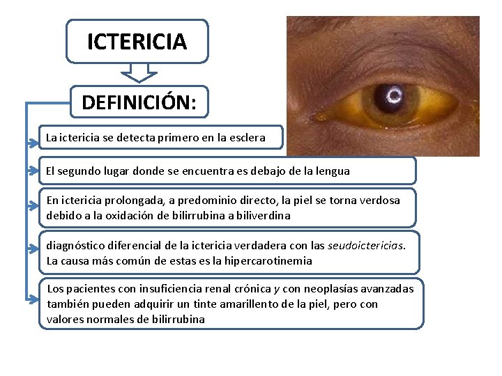 ICTERICIA Dr Alejandro Caas Coto Gastroenterlogo y Hepatlogo