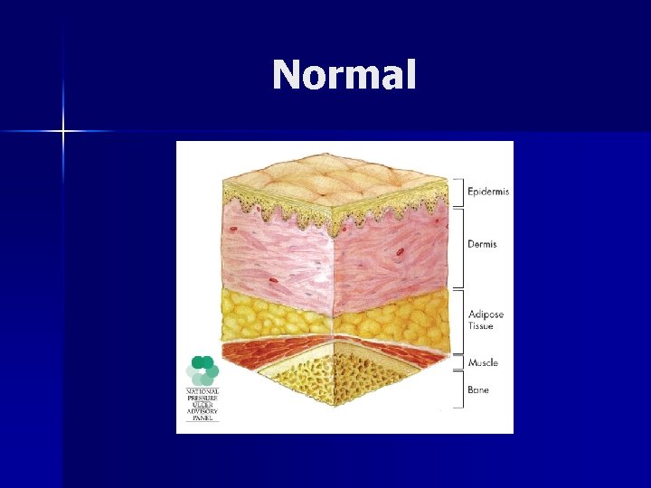 WoundSkin NICU Skills Day 2010 by Pam Dozier