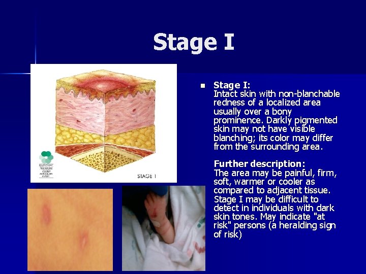 WoundSkin NICU Skills Day 2010 by Pam Dozier