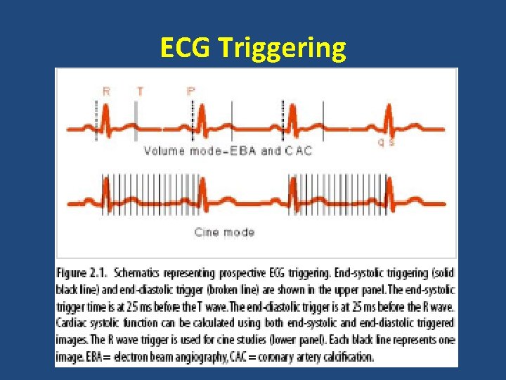 Cardiovascular computerized tomography Basics and evaluation of CAD