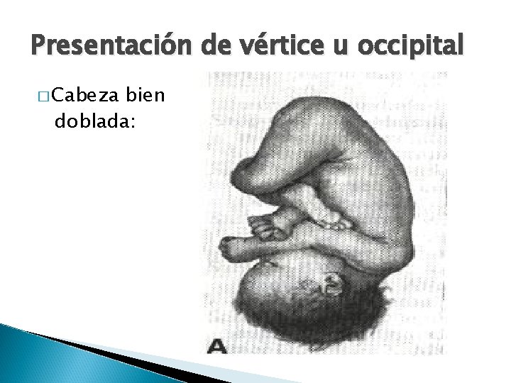 Presentacin Actitud Encajamiento y Fondo uterino Nancy Cortez