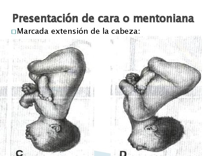 Presentacin Actitud Encajamiento y Fondo uterino Nancy Cortez