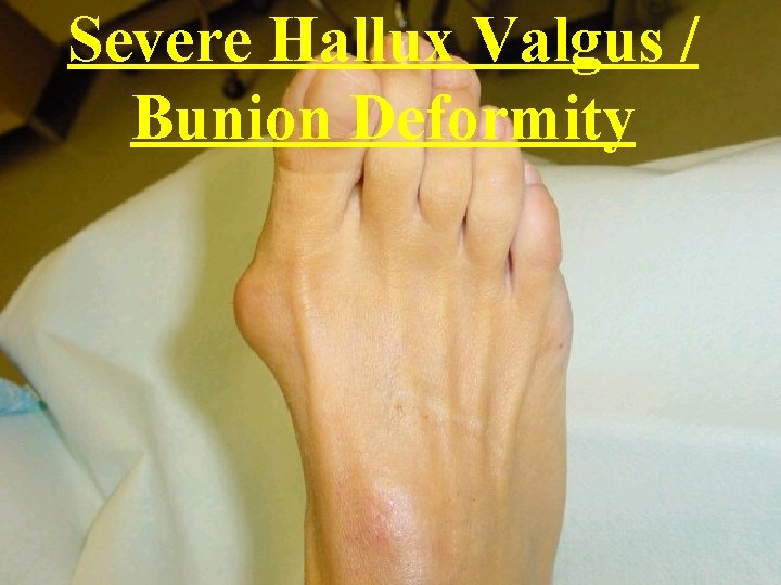 Common Foot Ankle Problems Created by Dr Willard