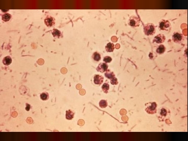 SHIGELLA Enterocolitis Bacillary dysentery ENTERIC GRAM NAGATIVE RODS