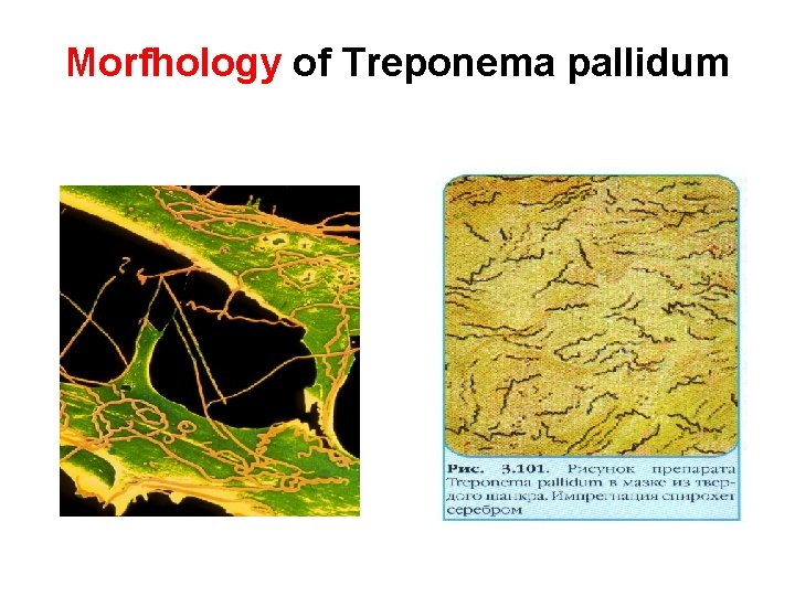Pathogenic spirochetes Classification biological properties and their role