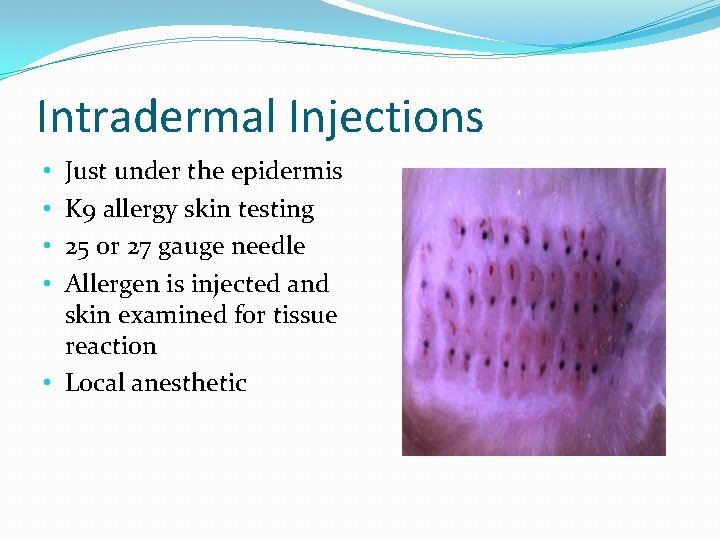 Routes of Administration Part 2 Intravenous Injections IV