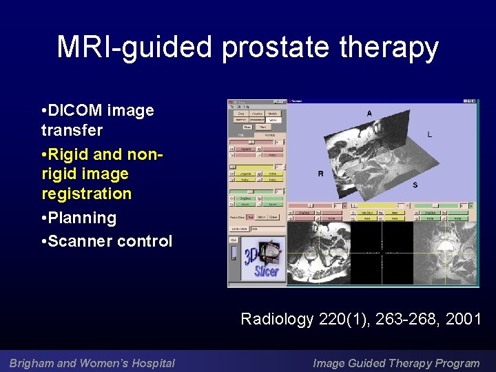 Brigham and Womens Hospital Image Guided Therapy Program