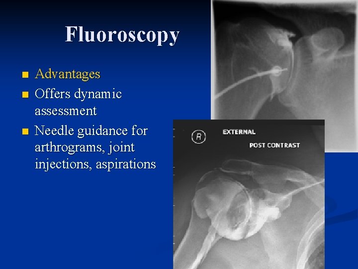 What Imaging Study Should I Order for Approach