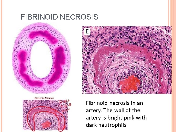 CELL INJURY PART 1 Sufia Husain Assistant Prof
