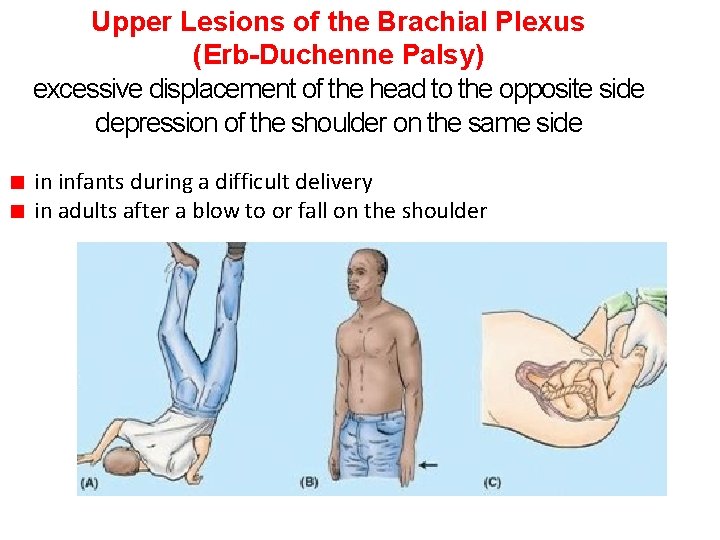 CASE 1 CASE 1 Dystocia Waiters tip sign