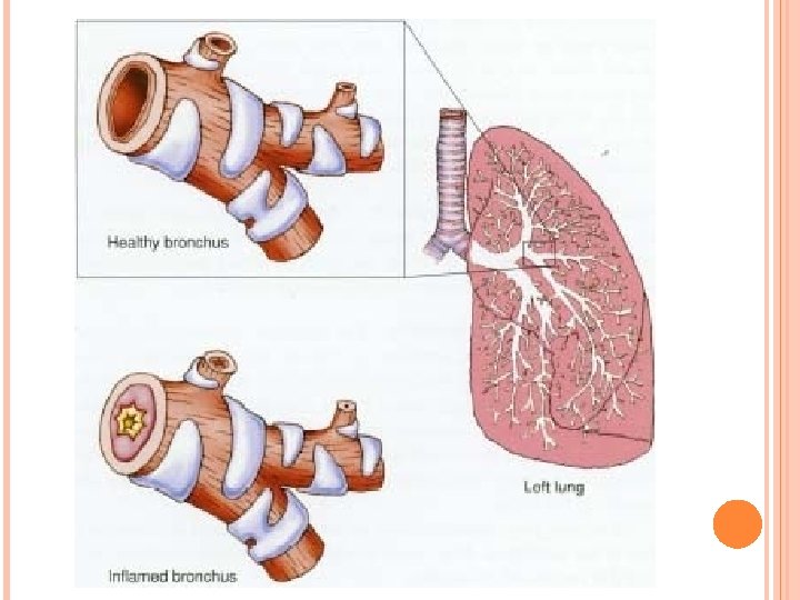RESPIRATORY DISORDERS Unit 4 Internal Systems Miss Kruzlics