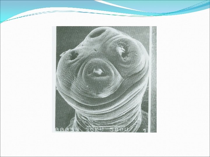 Human parasitology tapeworm common features of Class Cestoda