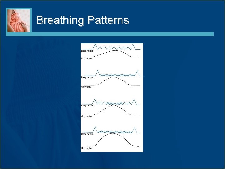 Chapter 7 Nursing Management of Pain During Labor