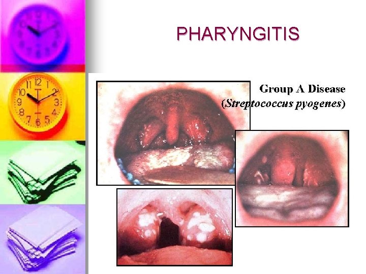 GASTROINTESTINAL DISORDERS NURSING DIAGNOSIS INTERVENTIONS DISTURBED ...