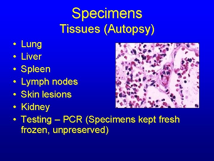 Bioterrorism Agents Plague Lesson 4 Laboratory Objectives List