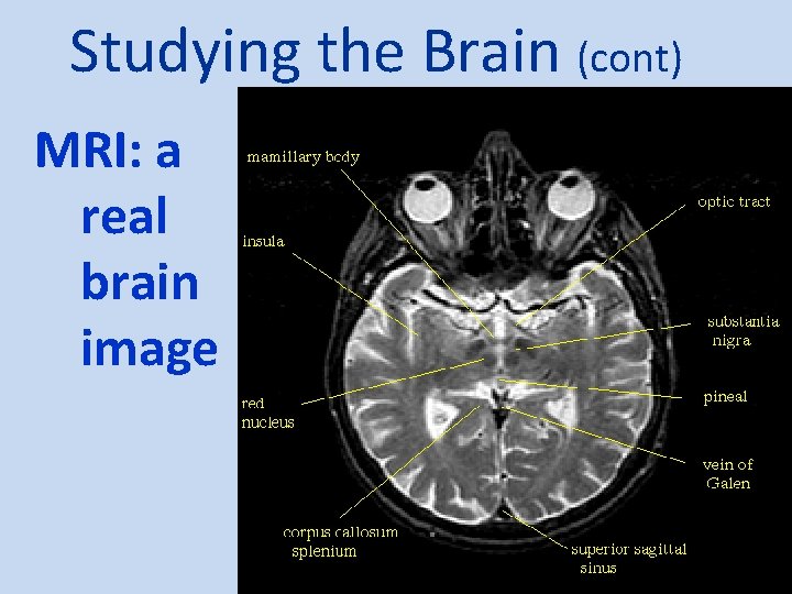6 2 C Studying the Brain A MRI