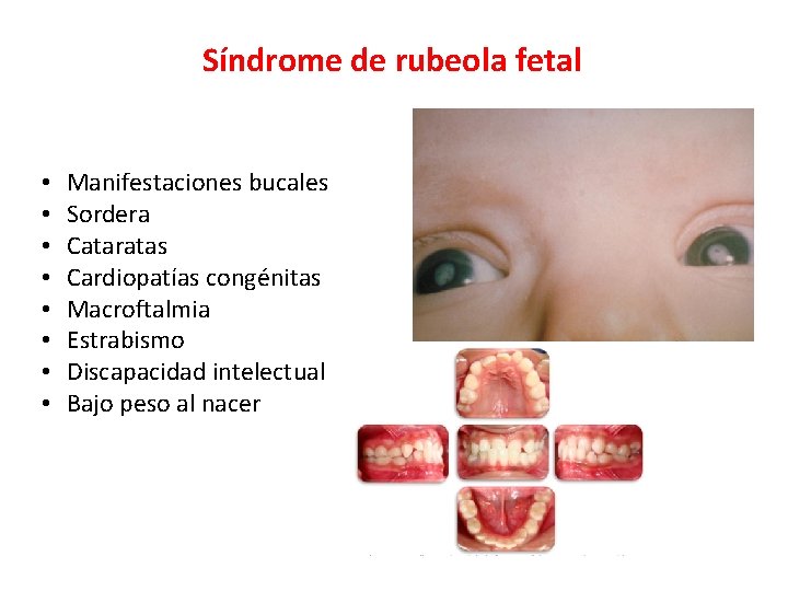 Introduccin a la Gentica Mdica Tema 7 Defectos