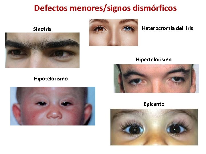 Introduccin a la Gentica Mdica Tema 7 Defectos
