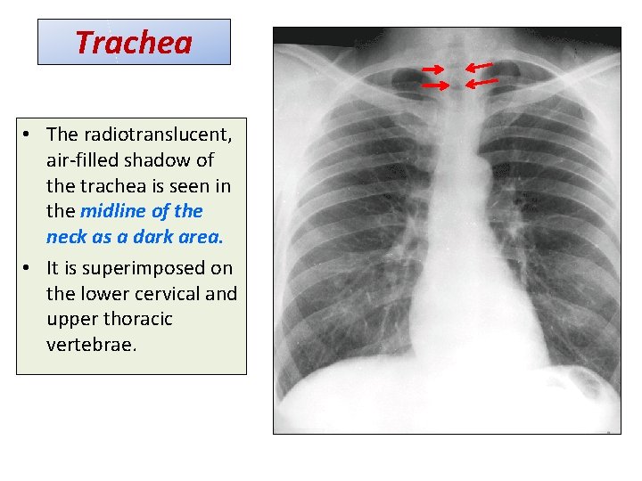 Radiological Anatomy of Thorax Prof Saeed Abuel Makarem