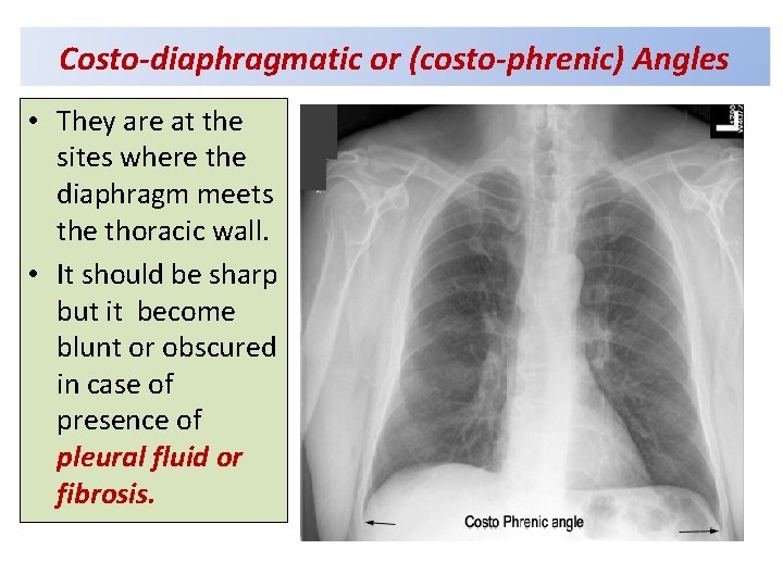Radiological Anatomy of Thorax Prof Saeed Abuel Makarem