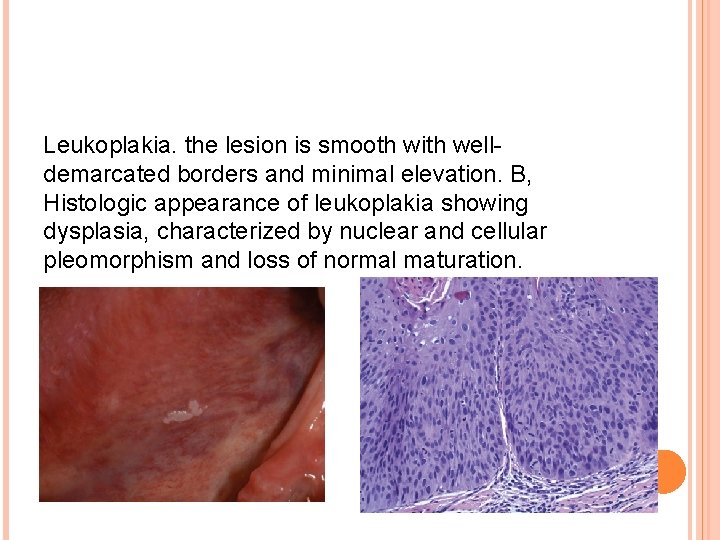 ORAL CAVITY Dr Bushra AlTarawneh MD The gastrointestinal