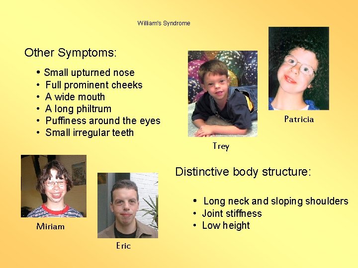 2004 Rano Sangwan Williams Syndrome A rare genetic