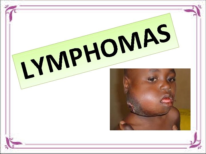 LYMPHOMAS SUBJECT CHILD HEALTH NURSING PREPARED BY MR