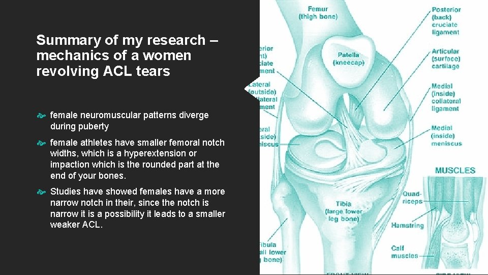 Why is it that ACL tears are more