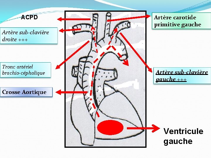 Angiologie du membre thoracique Pr SM BOUKERCHE Anne