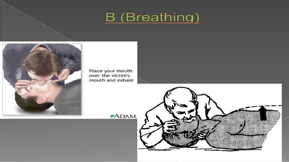 First aid of Respiration failure and Cardiac arrest