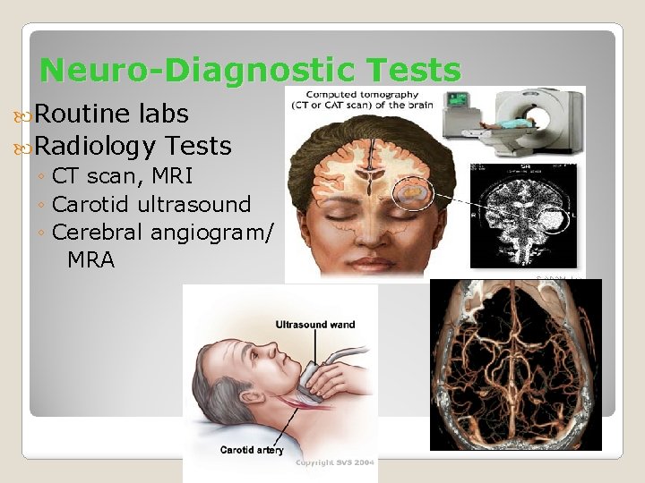 Neurological Disorders Chapter 8 Medical Considerations Brain Anatomy