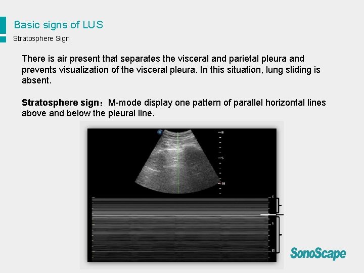 Lung Ultrasound Content 1 Basic Principle of LUS