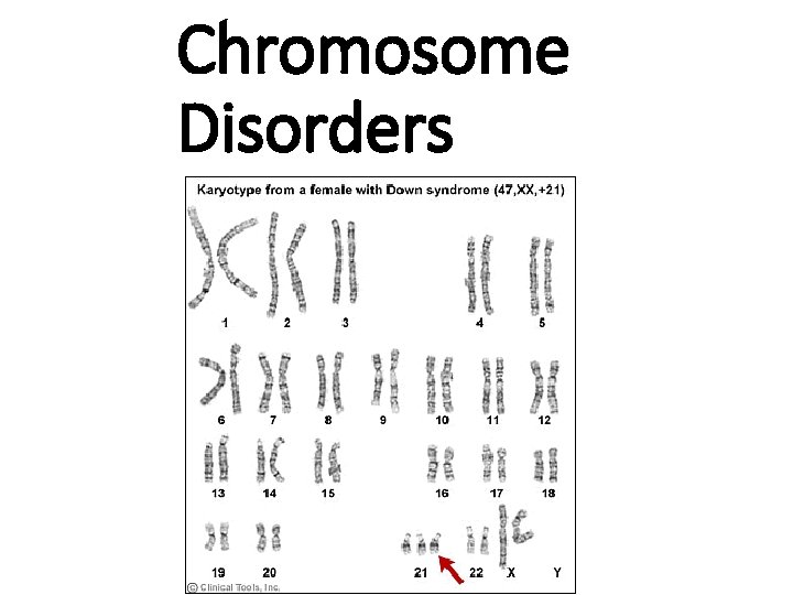 Chromosome Disorders Any syndrome malformations or malfunctions in