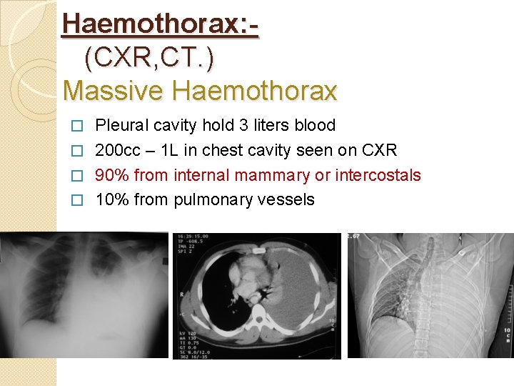 Chest Trauma By Prof Dr Mahmoud Khairy Prof