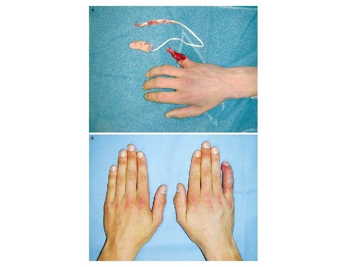 Skin Disorders Abrasions Lacerations Avulsions Punctures and Incisions