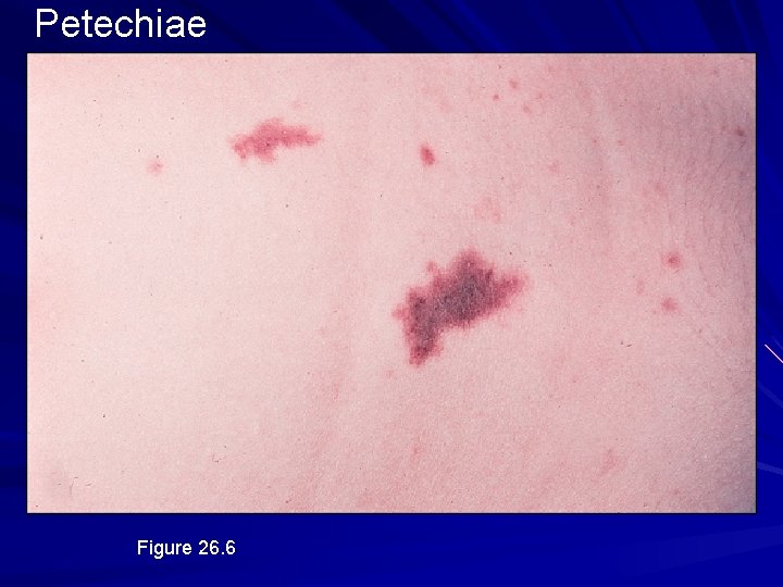 Bacterial and Viral Diseases Part 2 Genitourinary Nervous